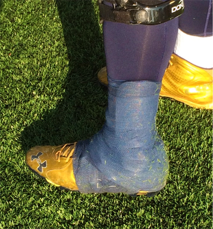 Over-the-Shoe Ankle Brace designed at Notre Dame. - Training & Conditioning